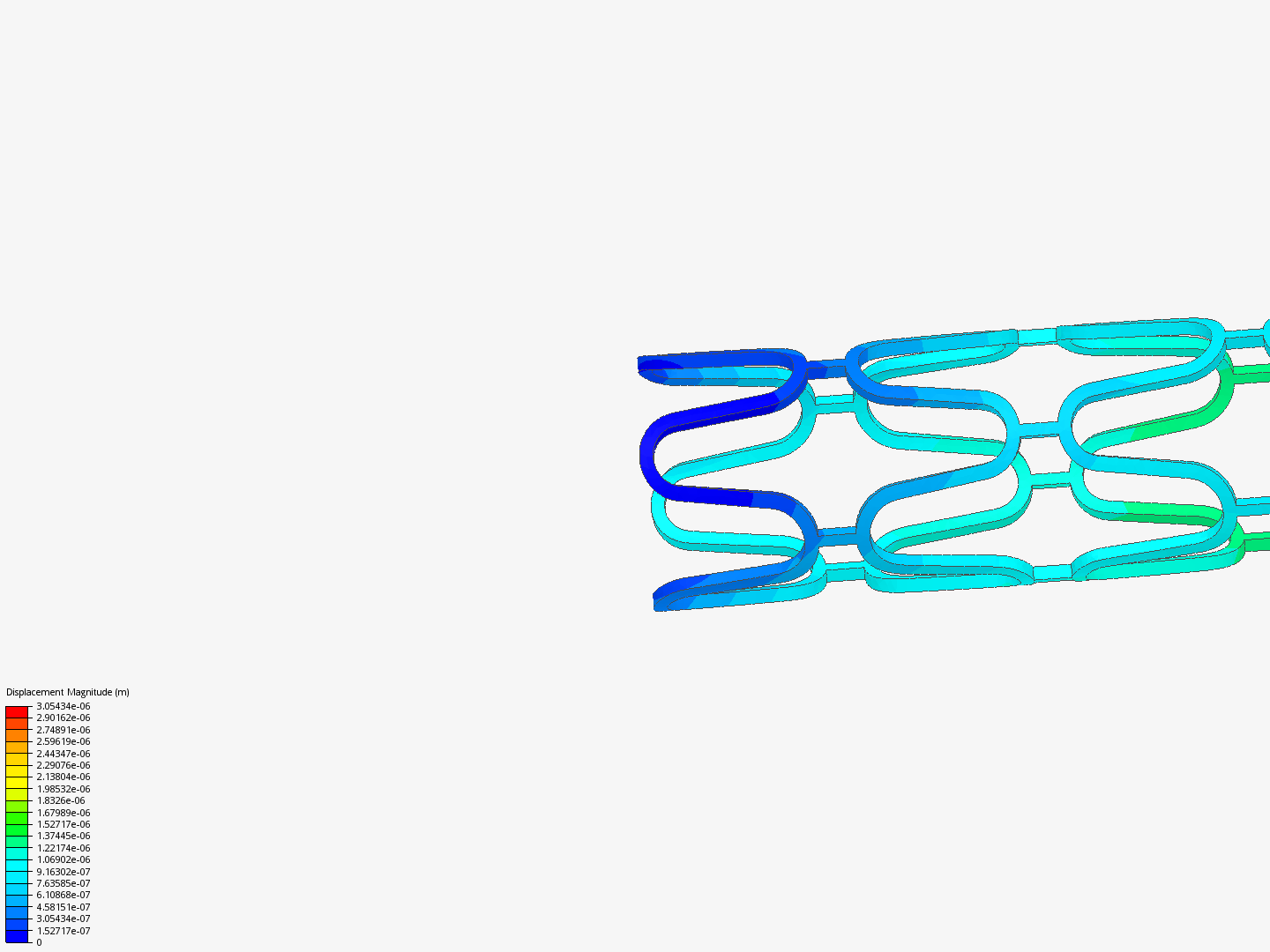 heart stent new project by 3omarmekki | SimScale