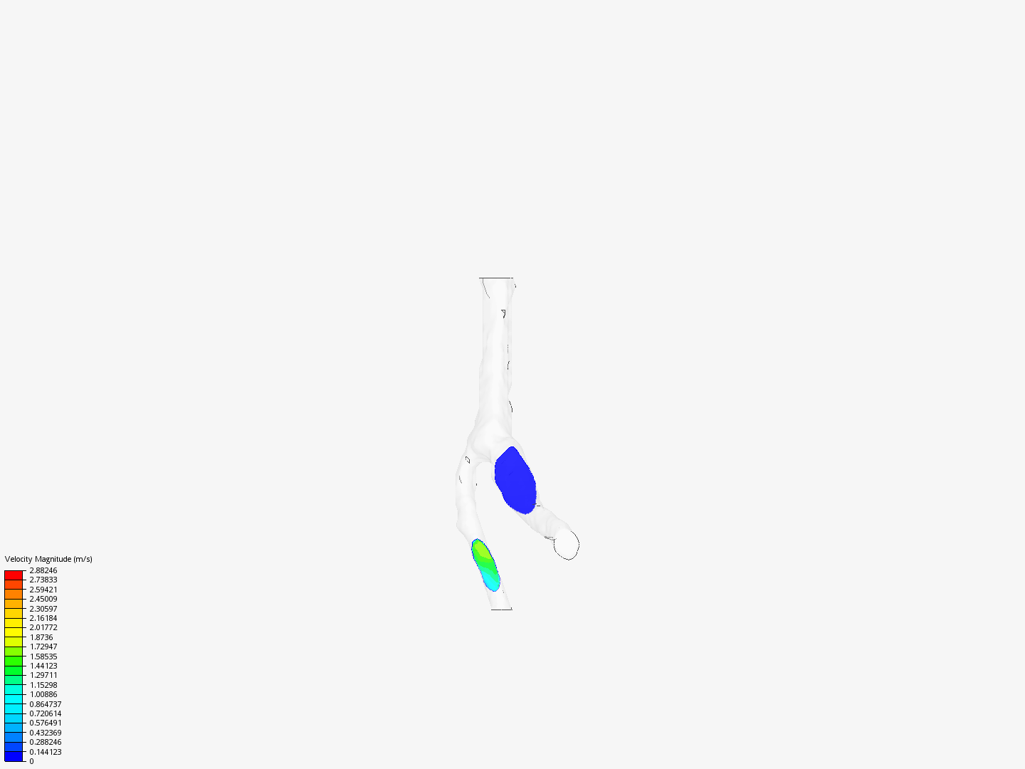 CFD Simulation - Blood Flow and Glucose Variability by GPAL37 | SimScale