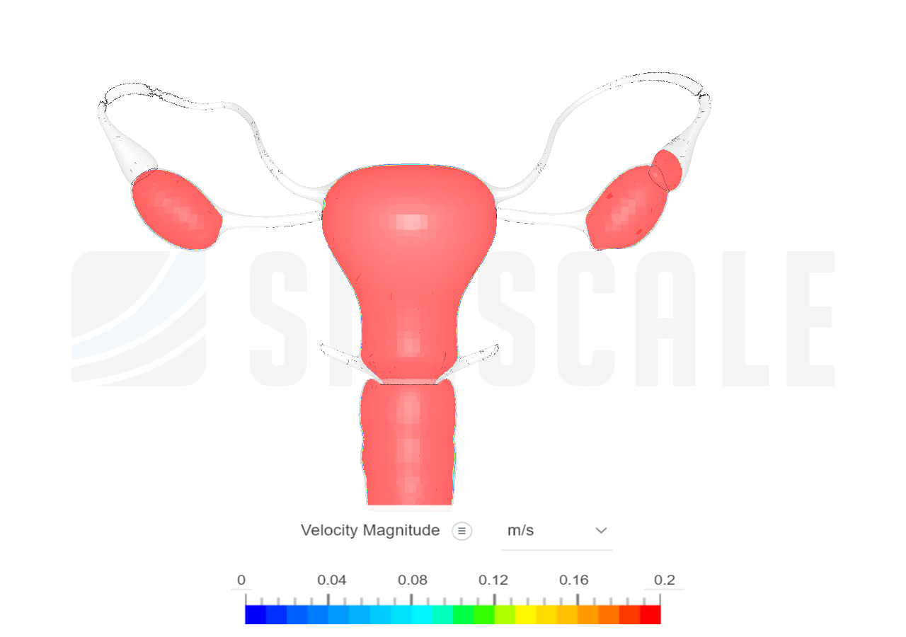 3d uterus model by Parthib | SimScale