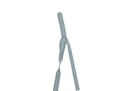 Blood Flow- Fluid Flow Simulation by ShaqkiraEmanuel | SimScale