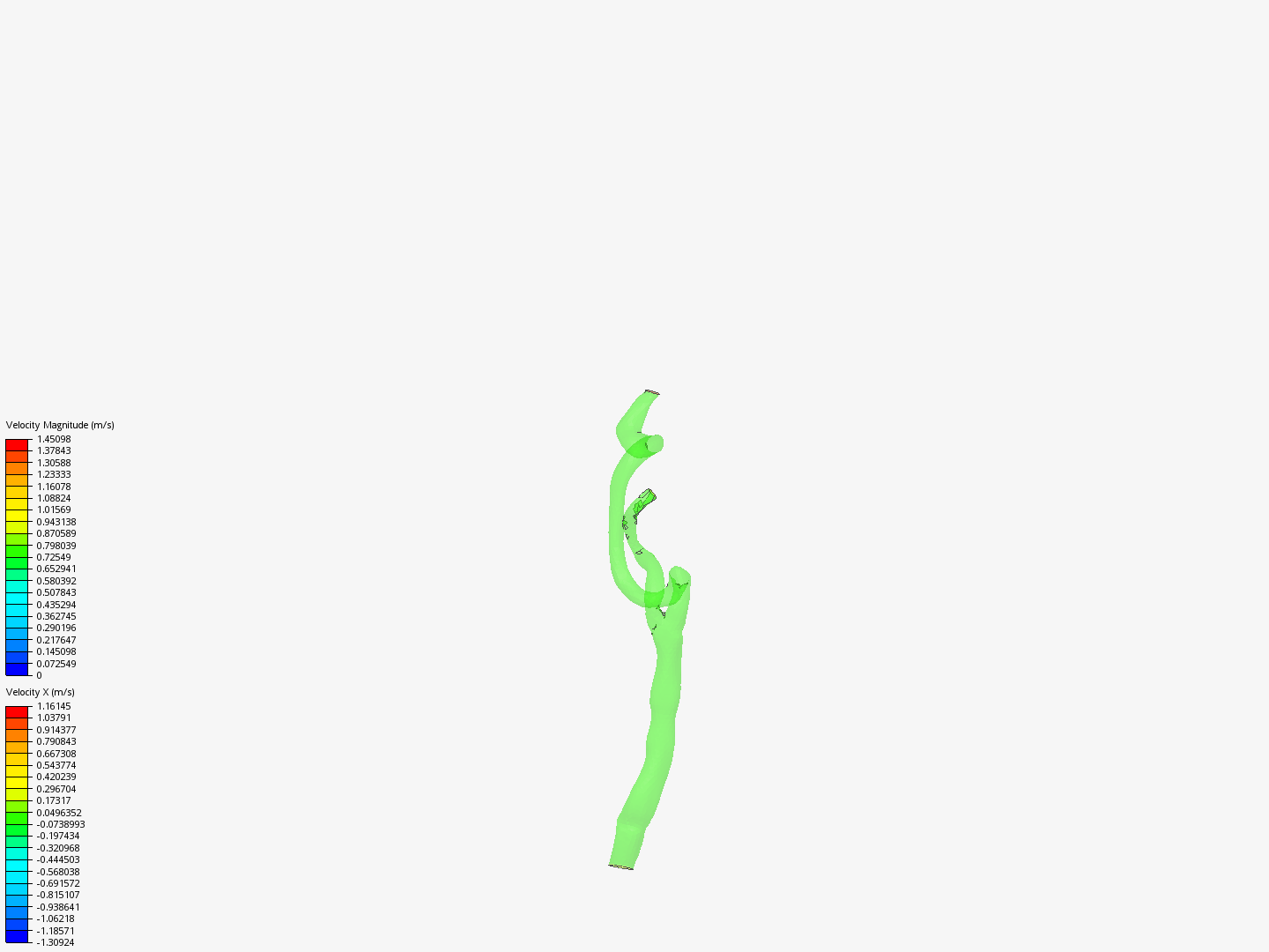 Carotid artery 2 by Shrabs | SimScale