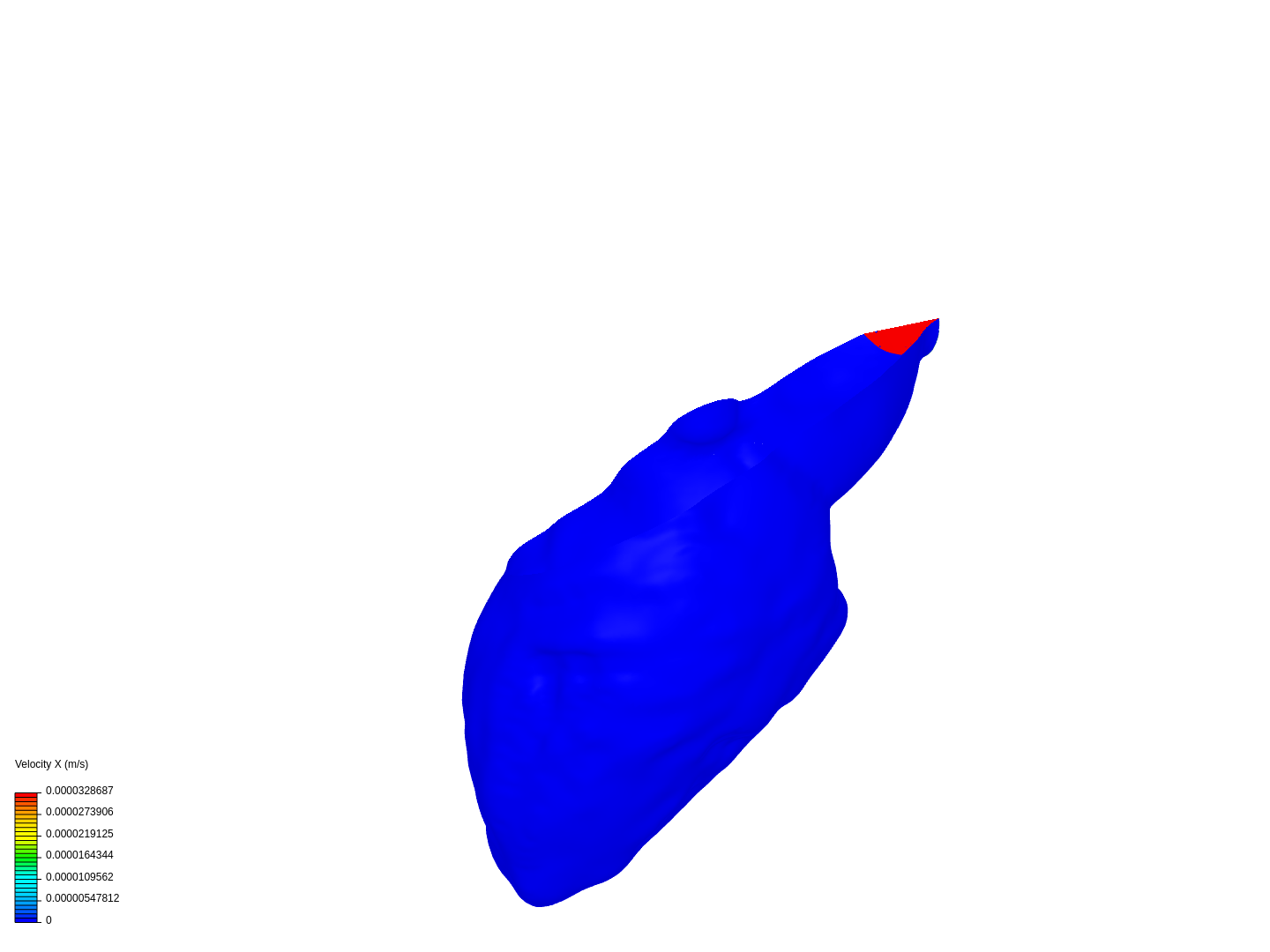 Left Heart by awilhelm | SimScale