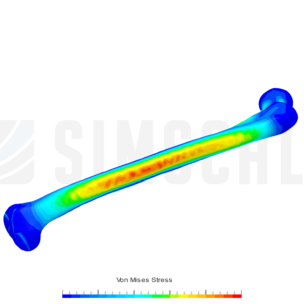 prueba_femur_cad by brenda_robledo | SimScale