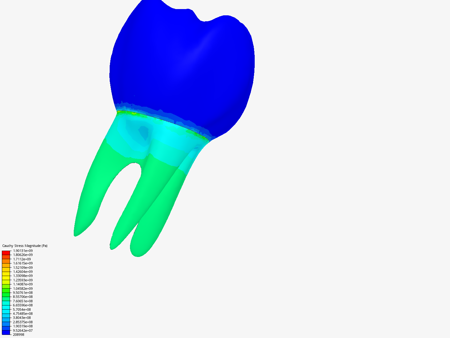 pulpe chamber by dlayouni | SimScale