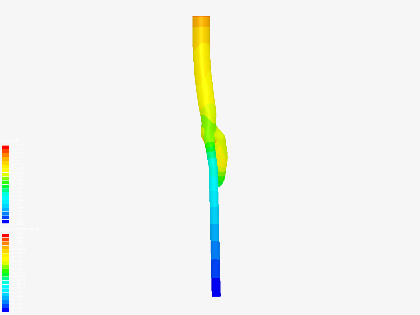Blood flow in a Carotid Artery Bifurcation - Homework by gstaniszewski | SimScale