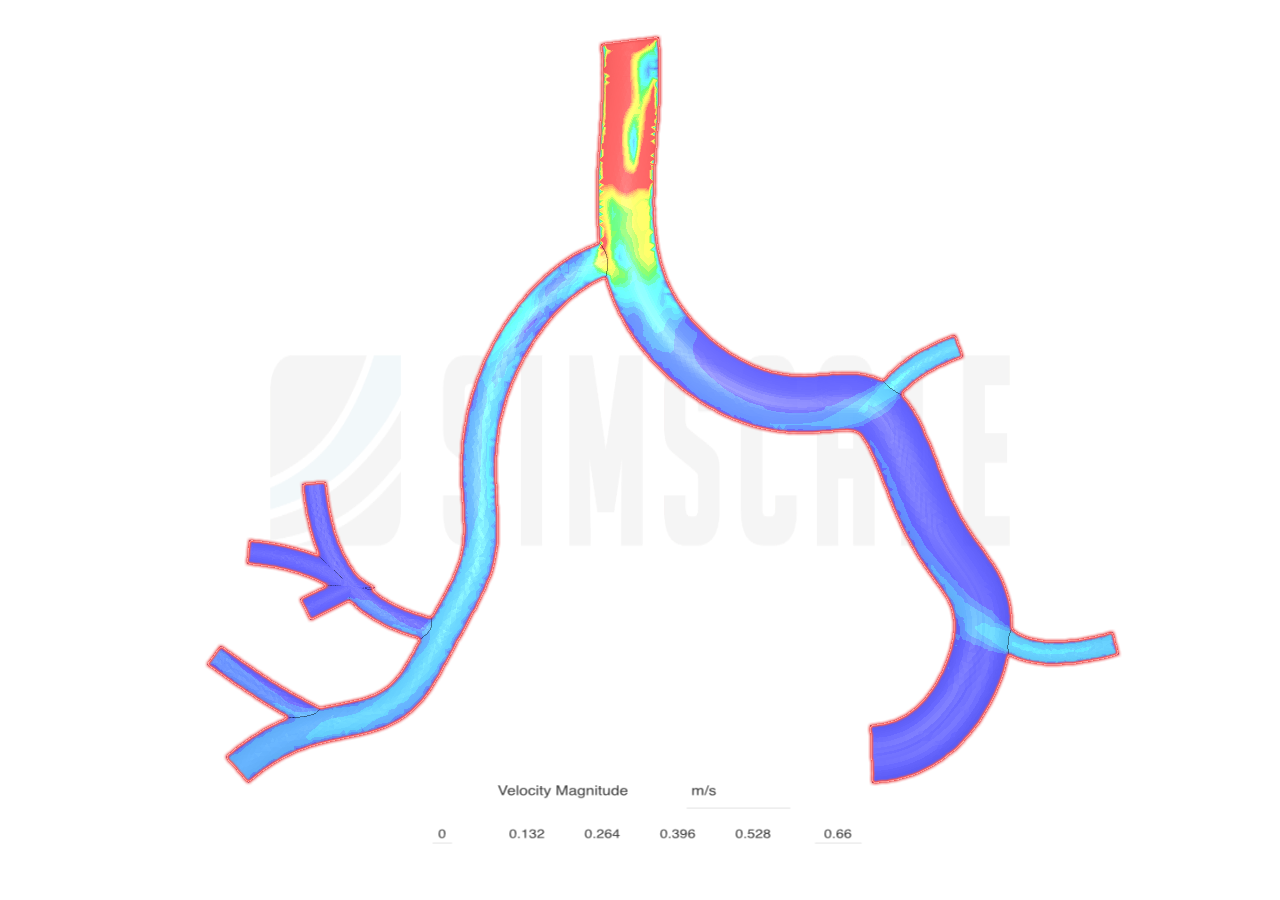 bbbbb by jcharlton | SimScale