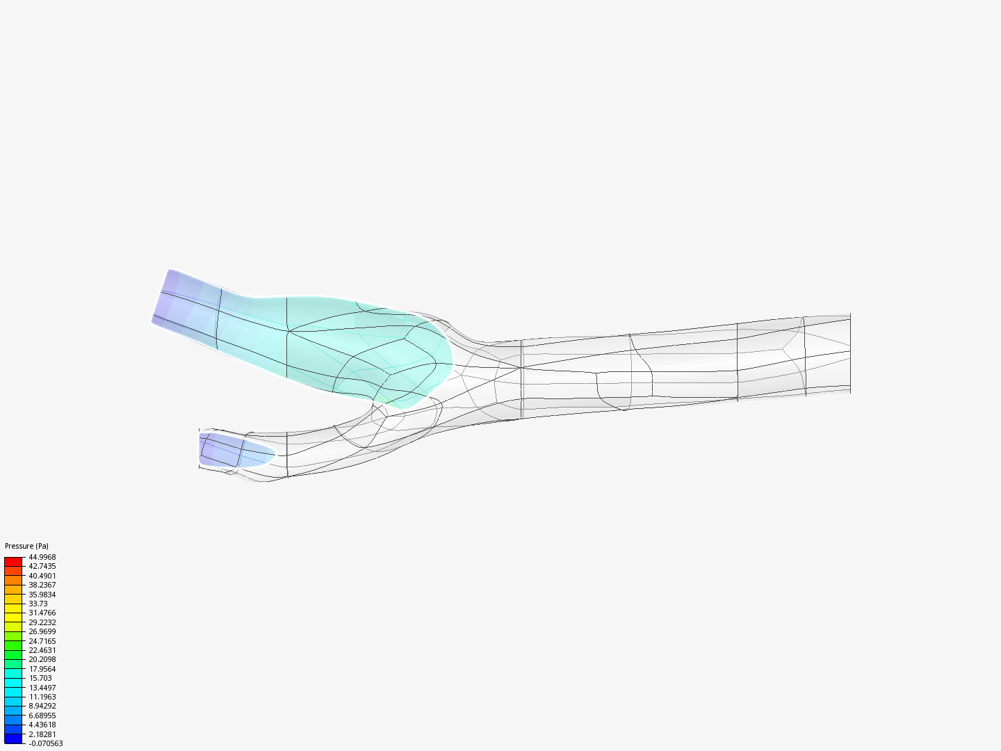 carotid 1 newtonian by jmo54 | SimScale