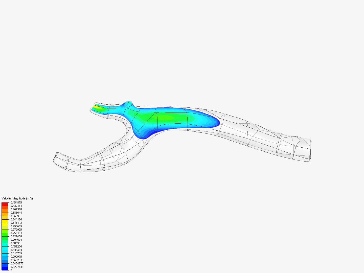 carotid 2 newtonian by jmo54 | SimScale