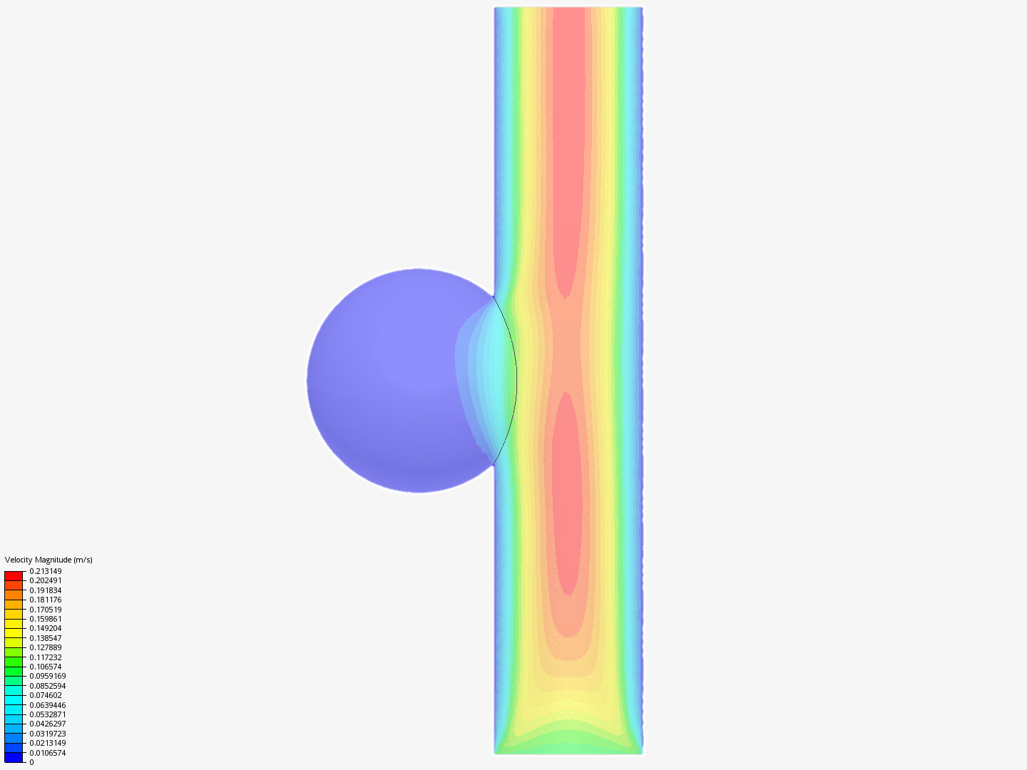 saccular aneurysm nonnewtonian by jmo54 | SimScale