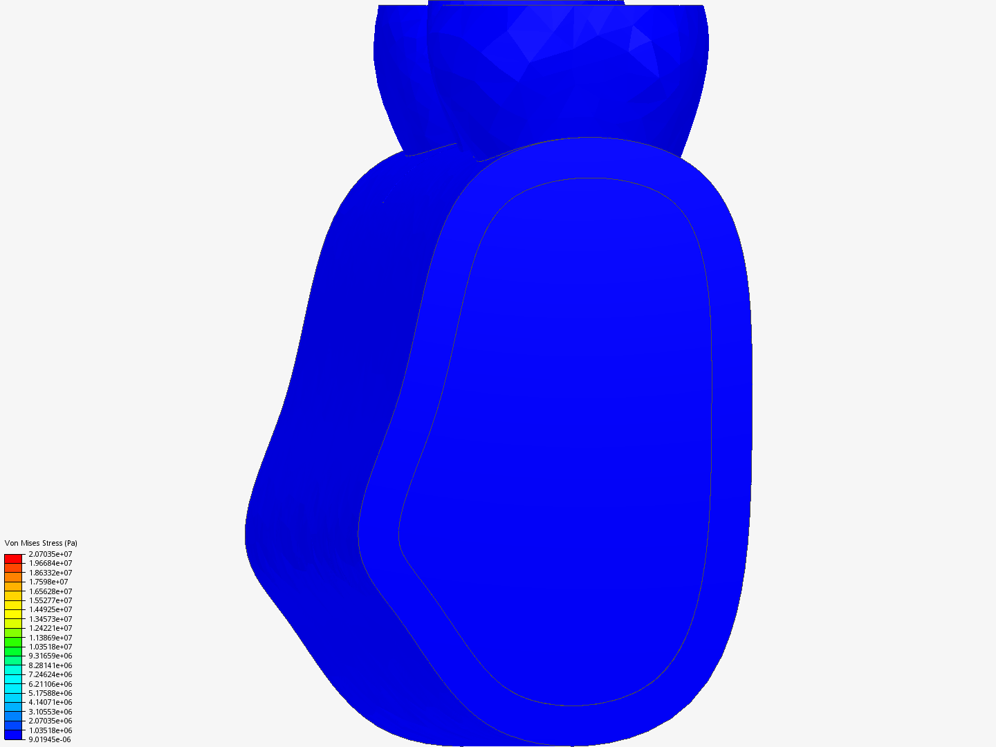 FEM dental implant by mariana_miram | SimScale