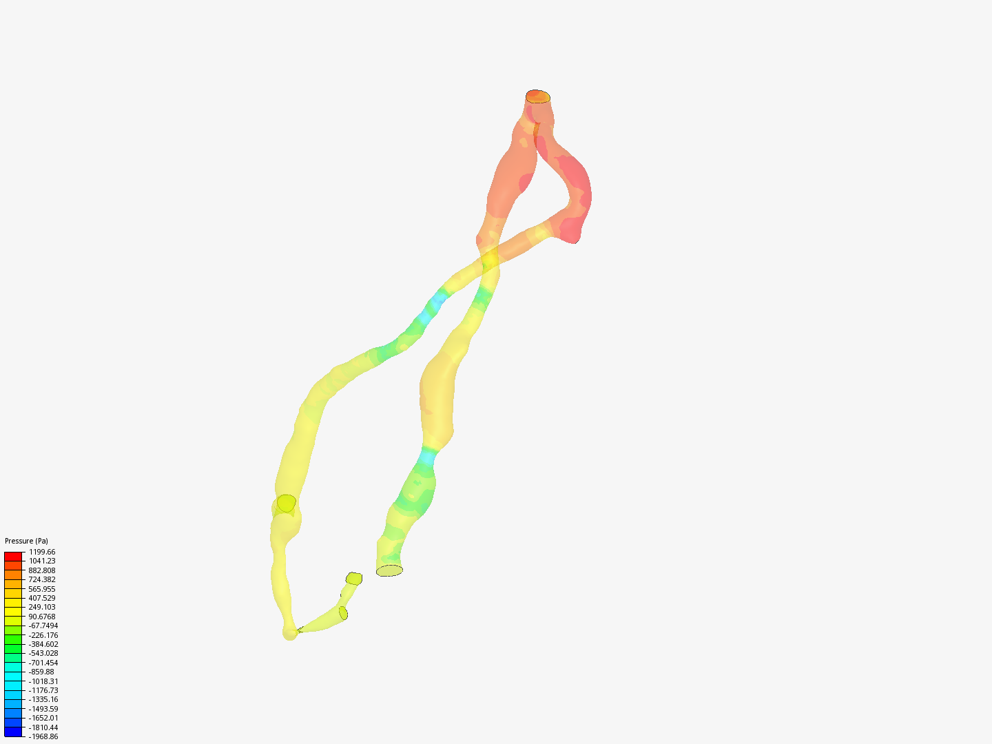 Blood Vessel by omersin | SimScale