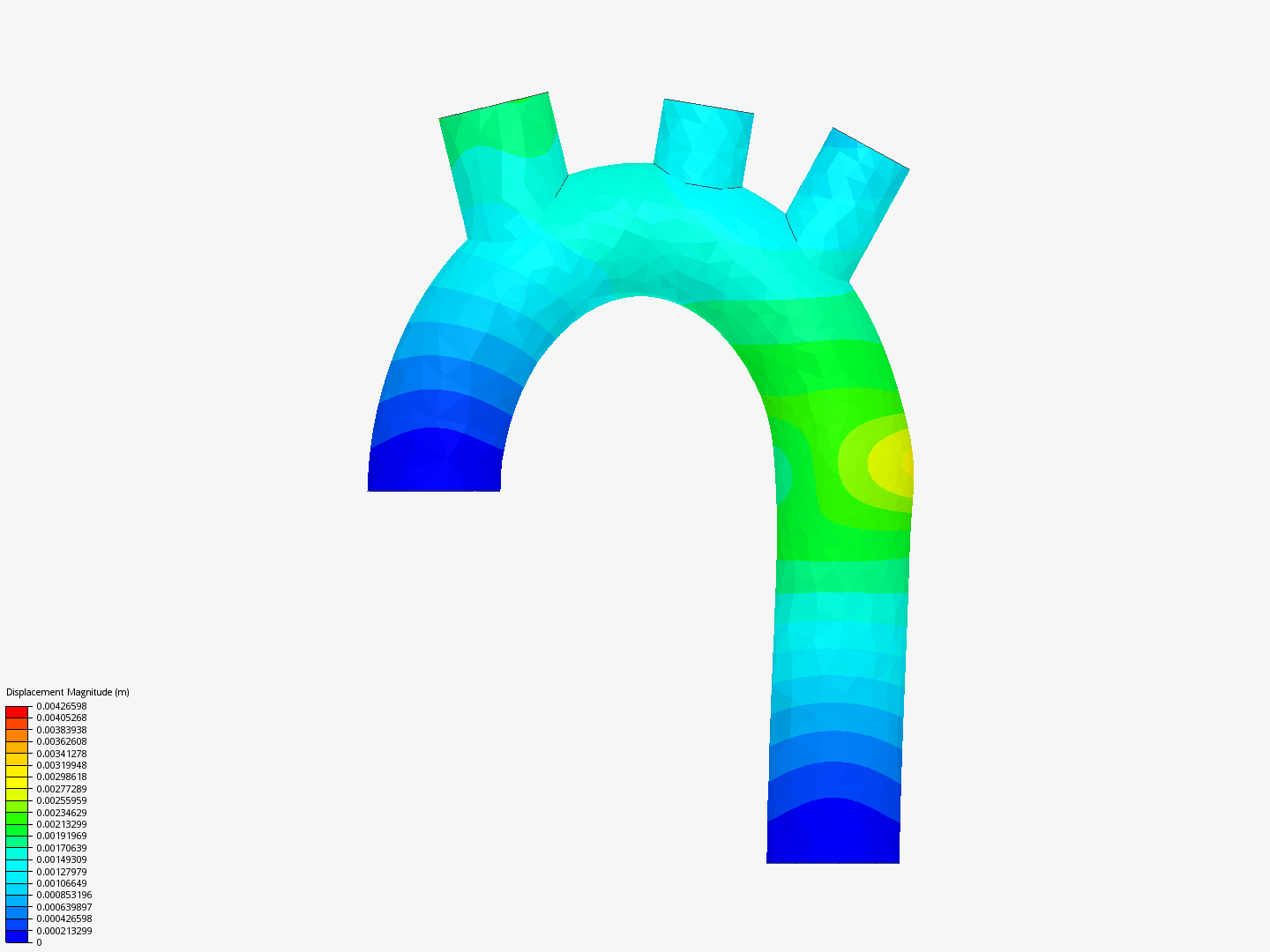 Aorta by rihard_petroff | SimScale
