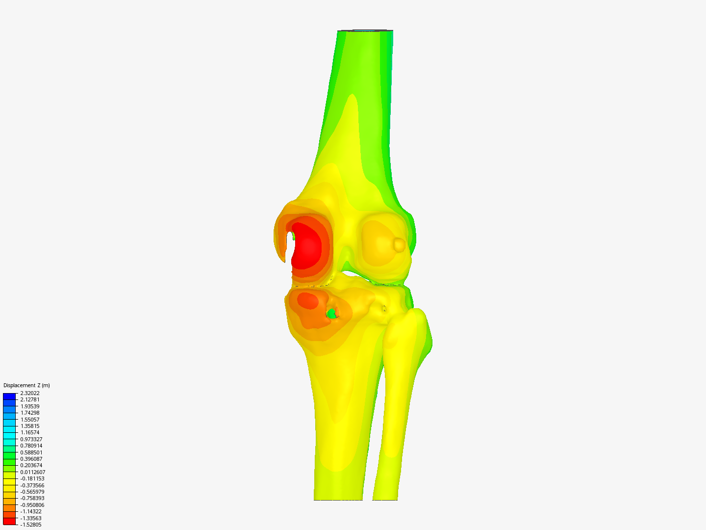 knee joint by sarammr0 | SimScale