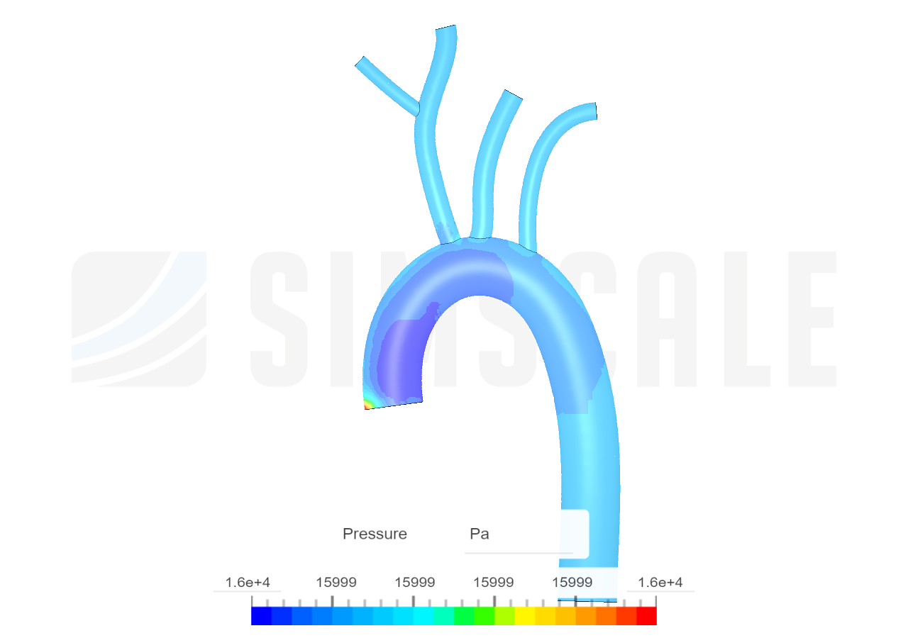 AORTY by tamoycampbell1 | SimScale