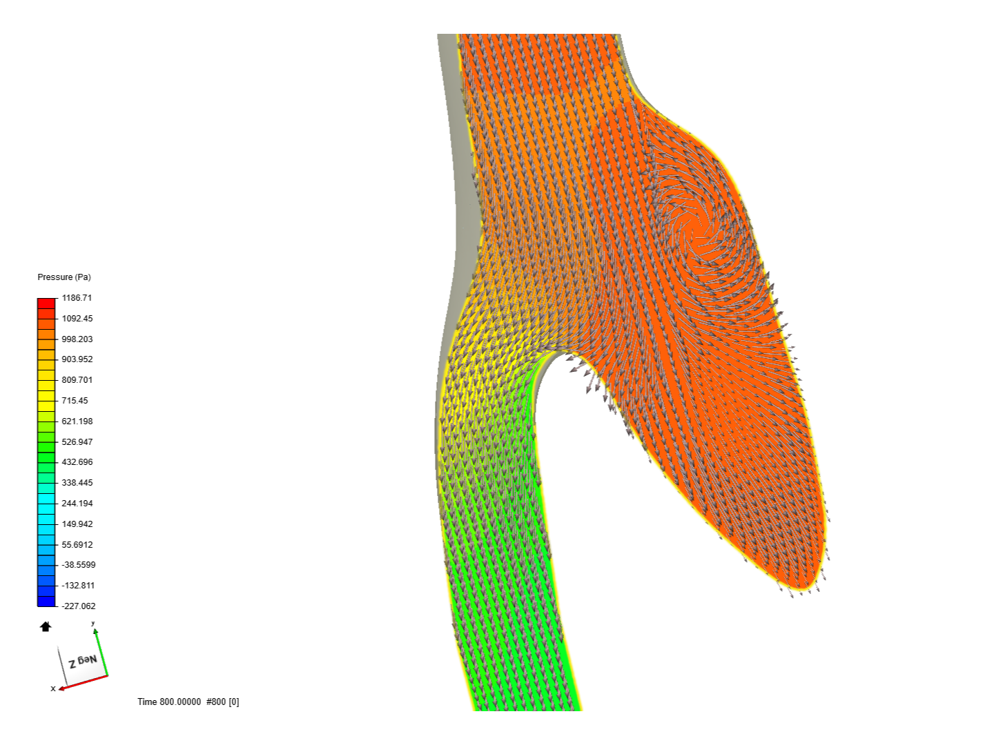 Practice Carotid by tberkman | SimScale