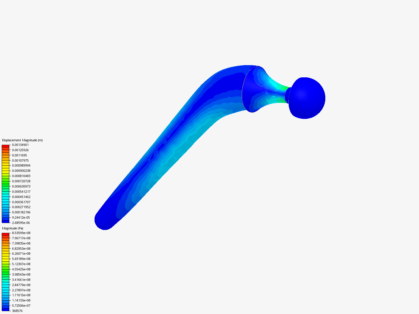 hip prothesis by thierry_hoc | SimScale