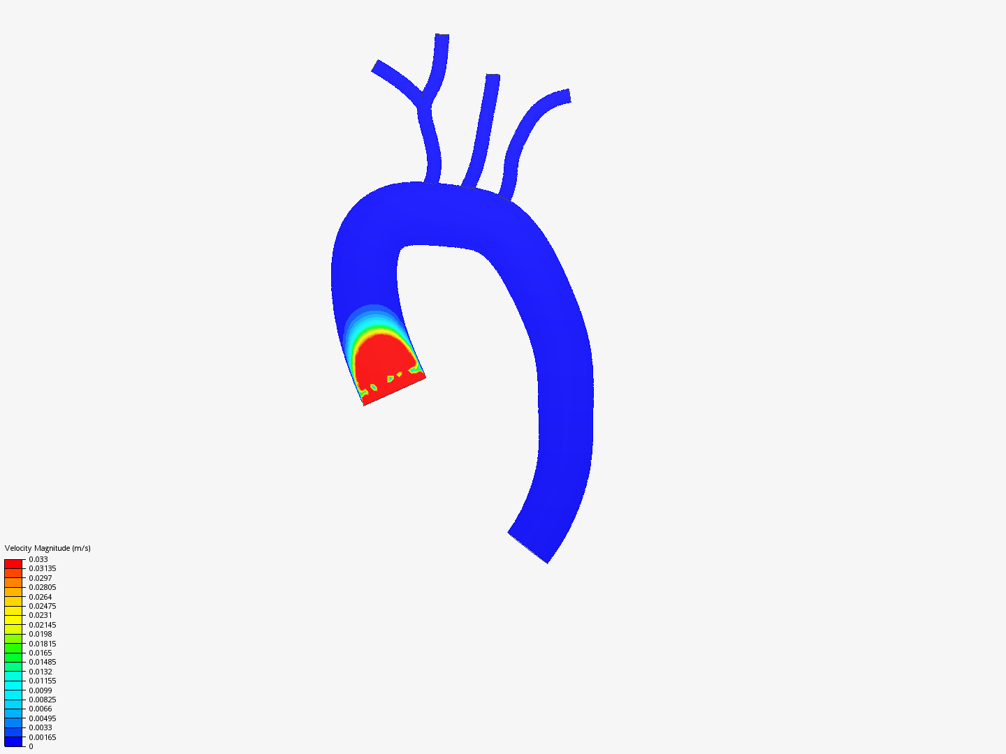 Blood Flow in Aorta by tucker_kristof | SimScale