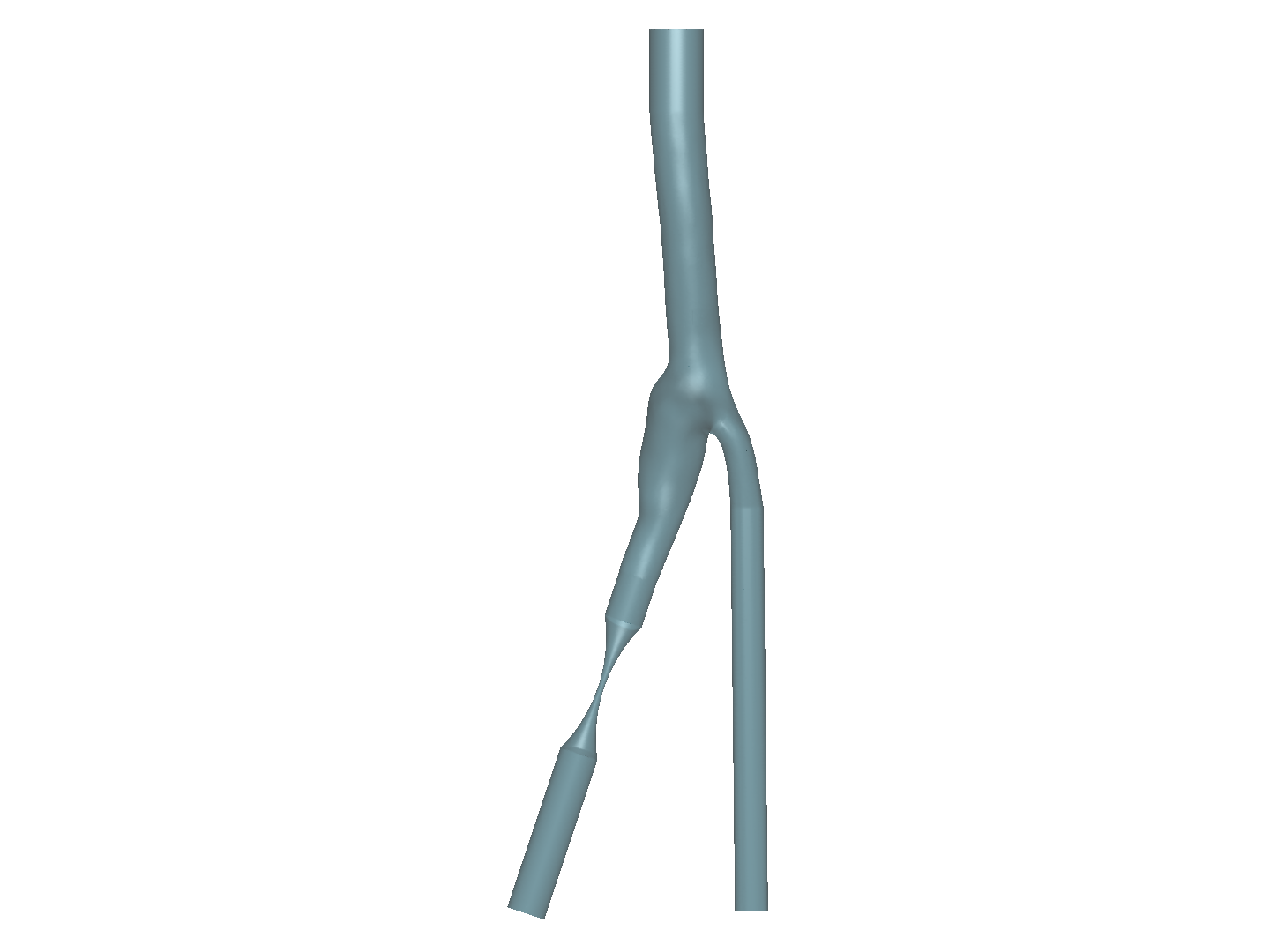 wajhee uddin Blood flow in carotid artery Bifurcation Model by wajheeuddin | SimScale