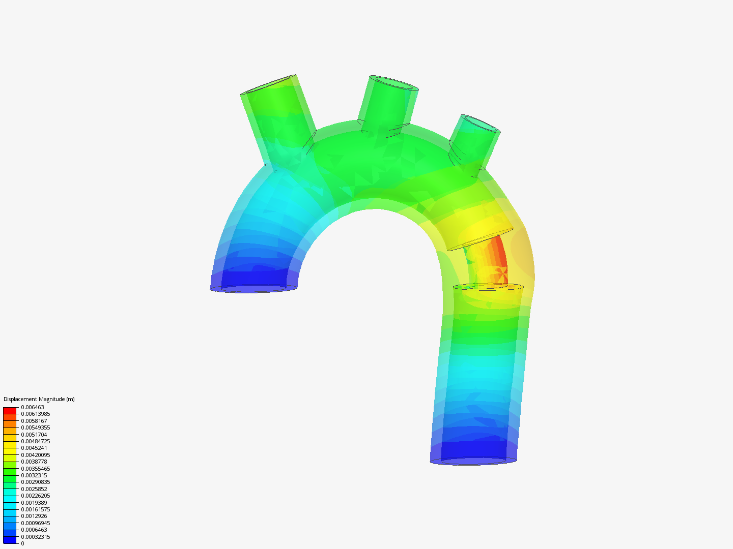 aorta by yan18091809 | SimScale