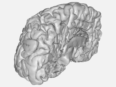 Brain Shift PINN Simulation by Pronob | SimScale