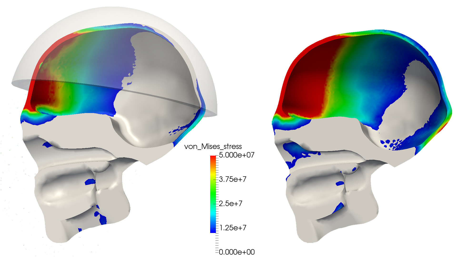 Impact Analysis of Skull with and without Helmet by ahmedhussain18 ...