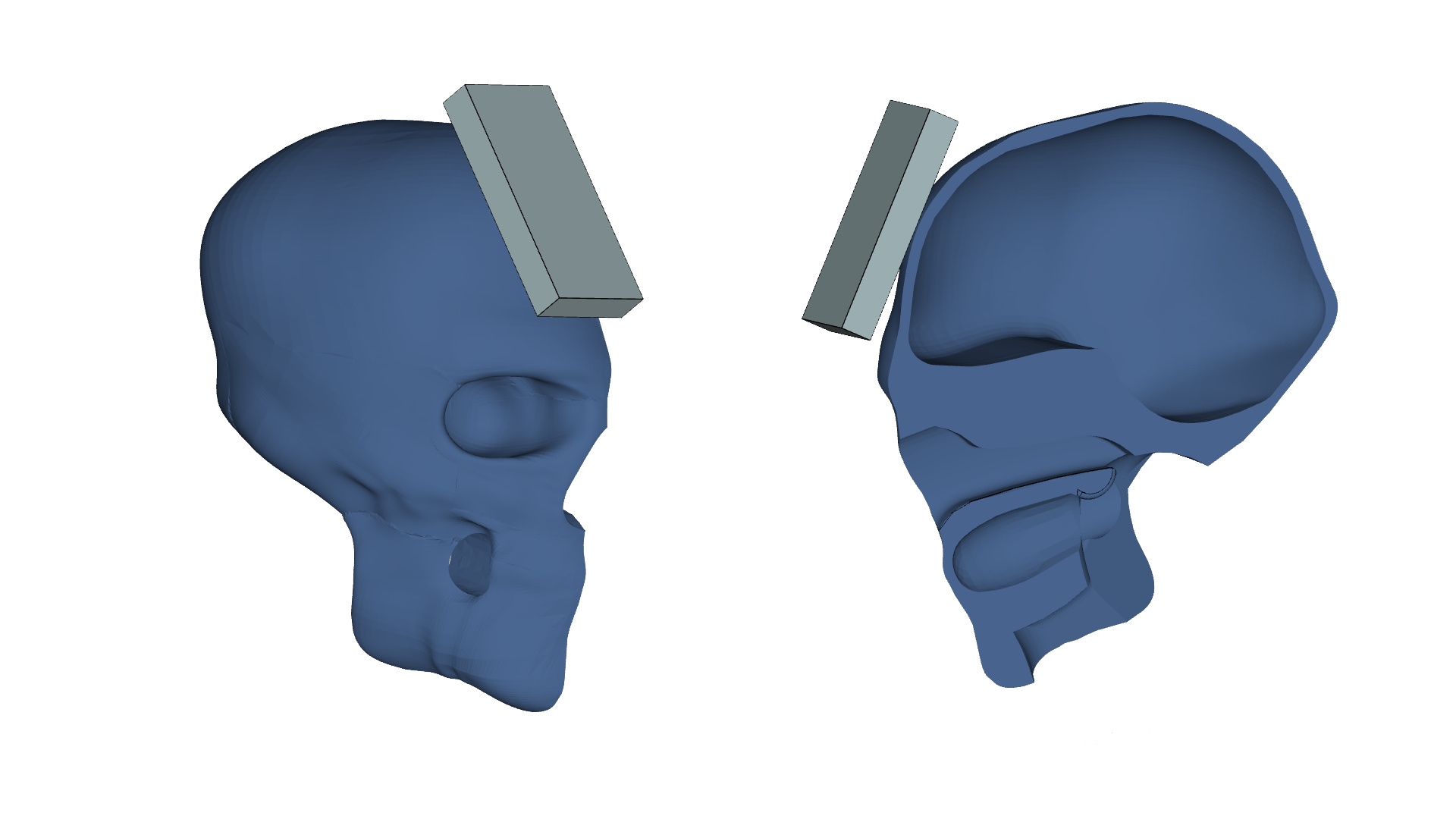 Impact Analysis of Skull with and without Helmet by ahmedhussain18 ...