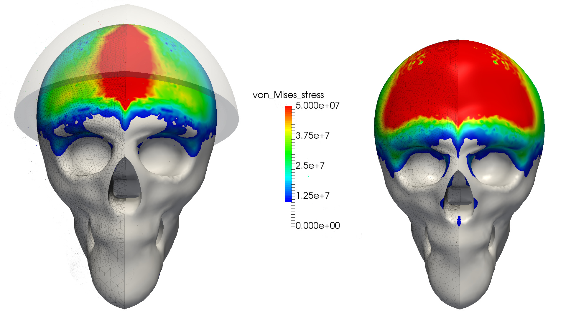 Impact Analysis of Skull with and without Helmet by ahmedhussain18 ...