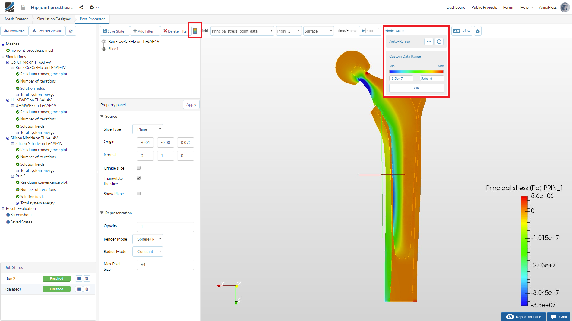 Step-by-Step Tutorial Session 1: Hip Joint Prosthesis - Solid Mechanics / FEA - SimScale CAE Forum